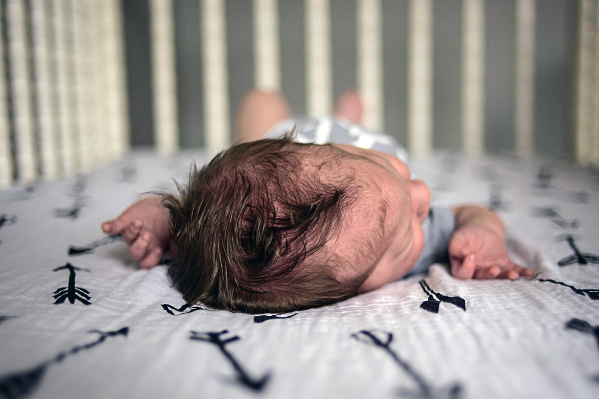 After skull reconstruction, Fitz’ brain has room to grow : Inside ...