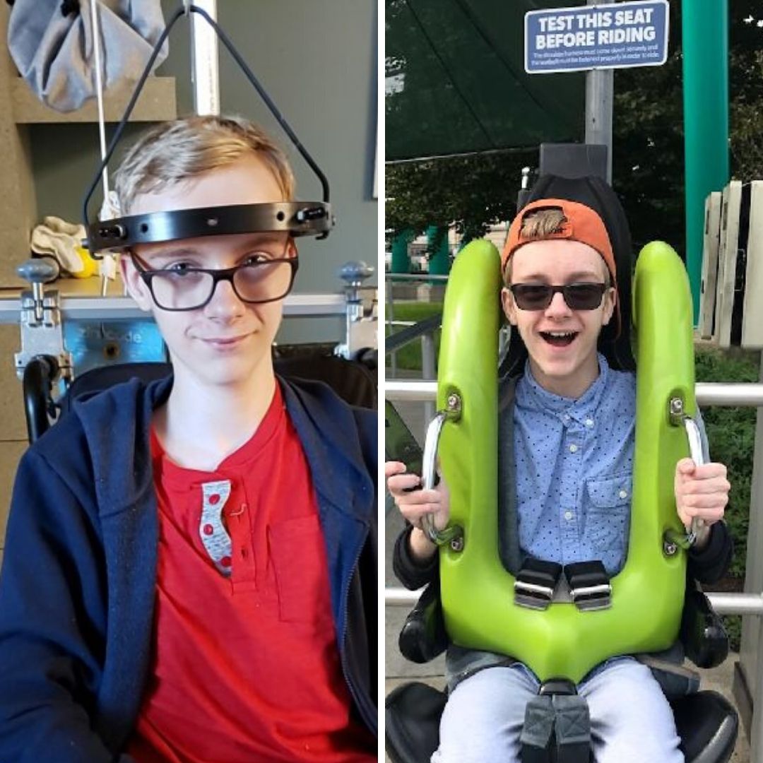 Halo traction therapy and spinal fusion surgery mean more ‘airtime’ for ...