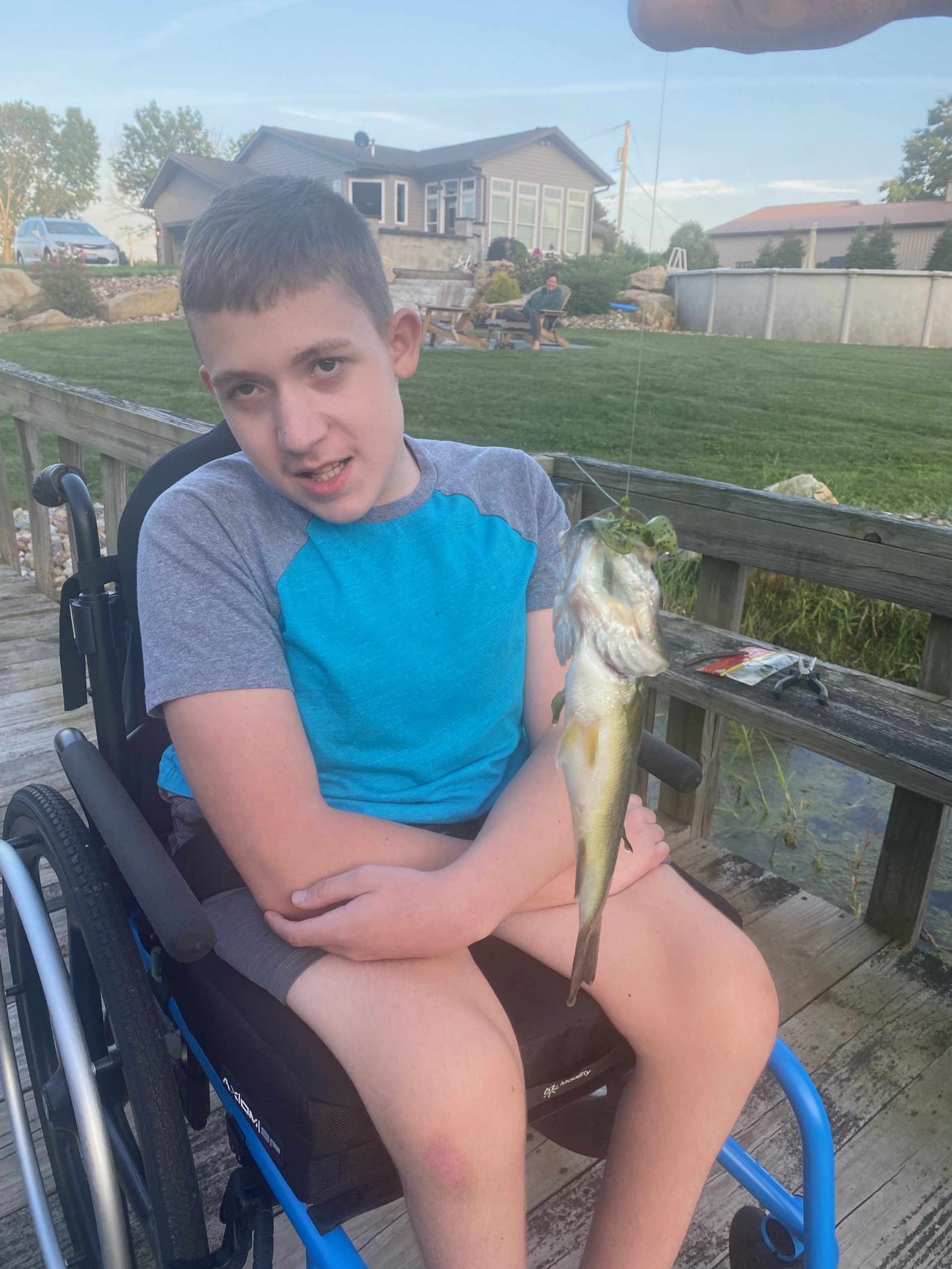 Shilla (growth) rods allow young scoliosis patient to continue to grow ...