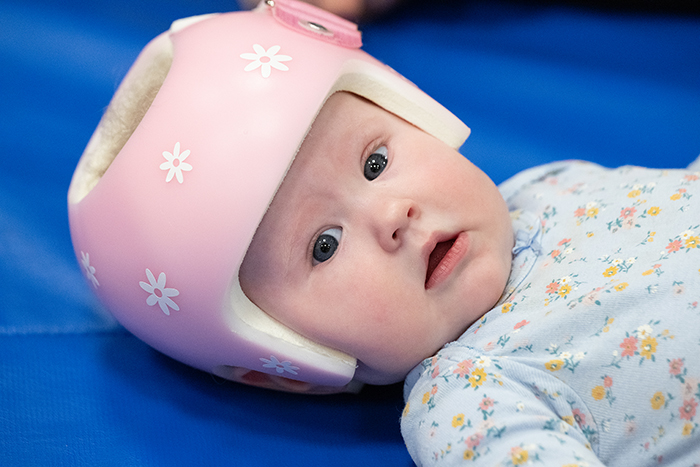 After shocking Prader-Willi diagnosis, baby Jayda is progressing by ...