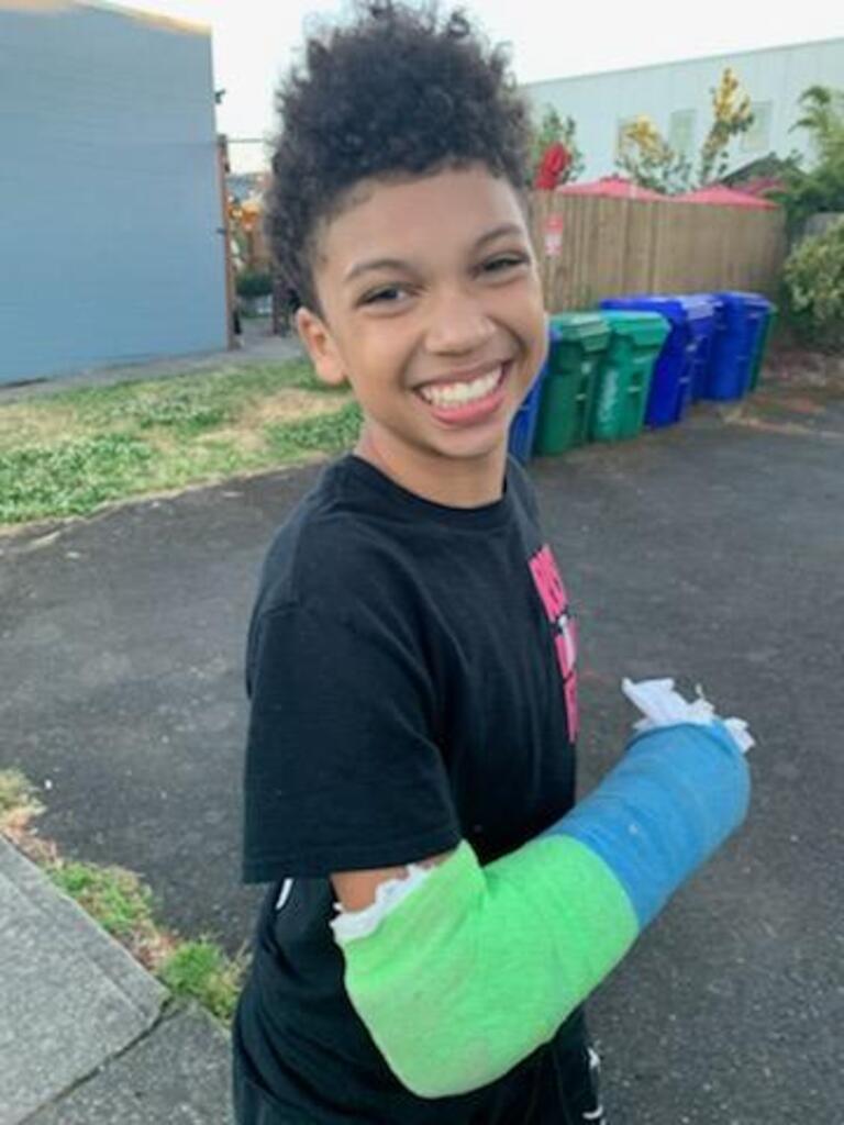 3D modeling helps ensure correct realignment of teenager’s wrist and ...