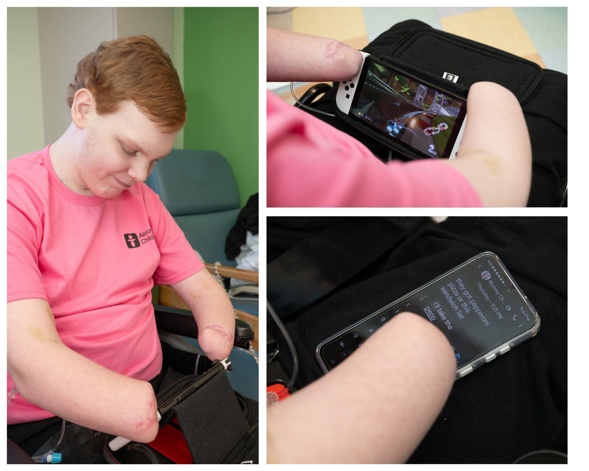 16-year-old looking toward the future after having hands and feet ...