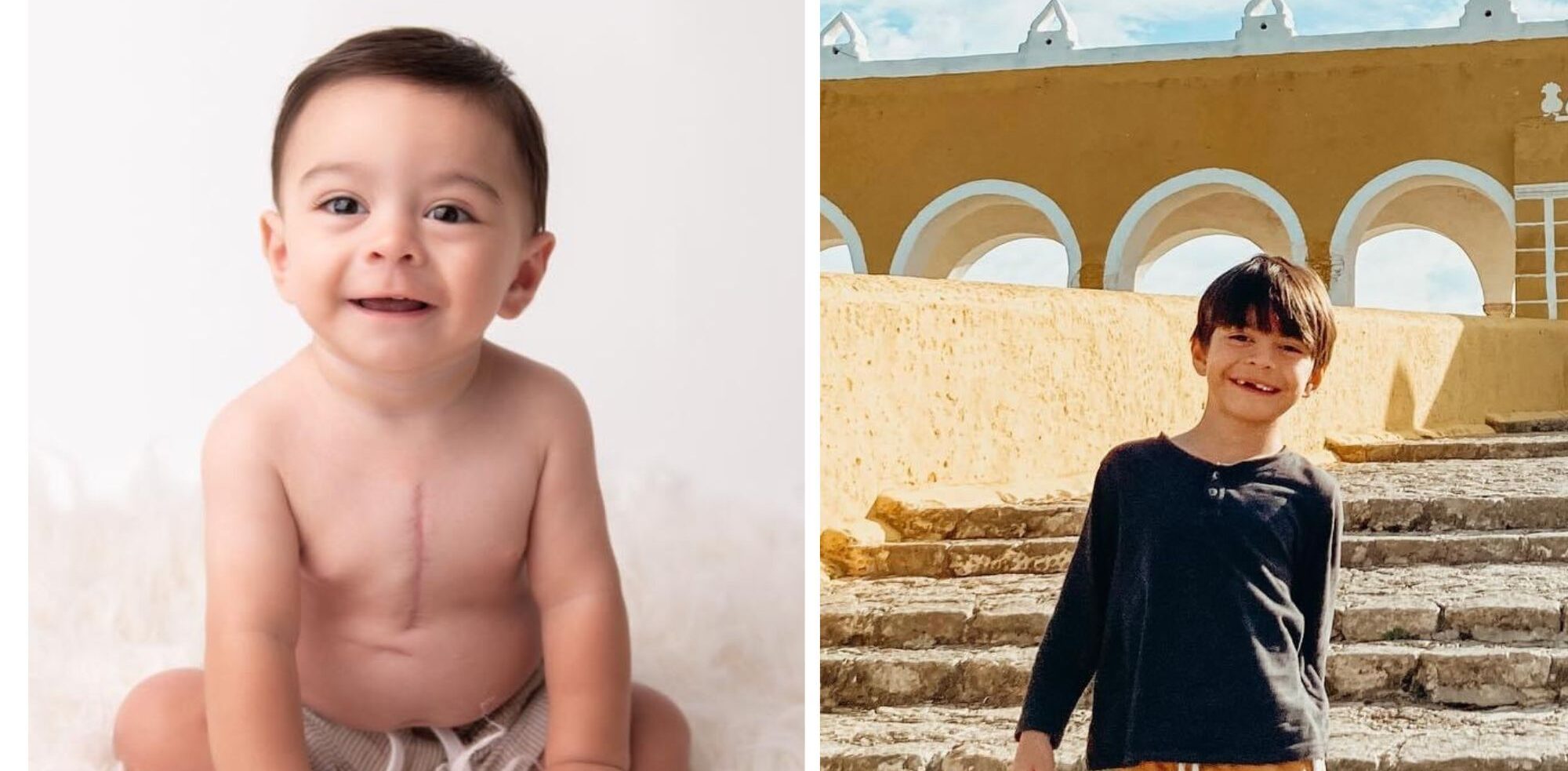 Mending tiny hearts: Surgery for congenital heart defect gives 6-year ...