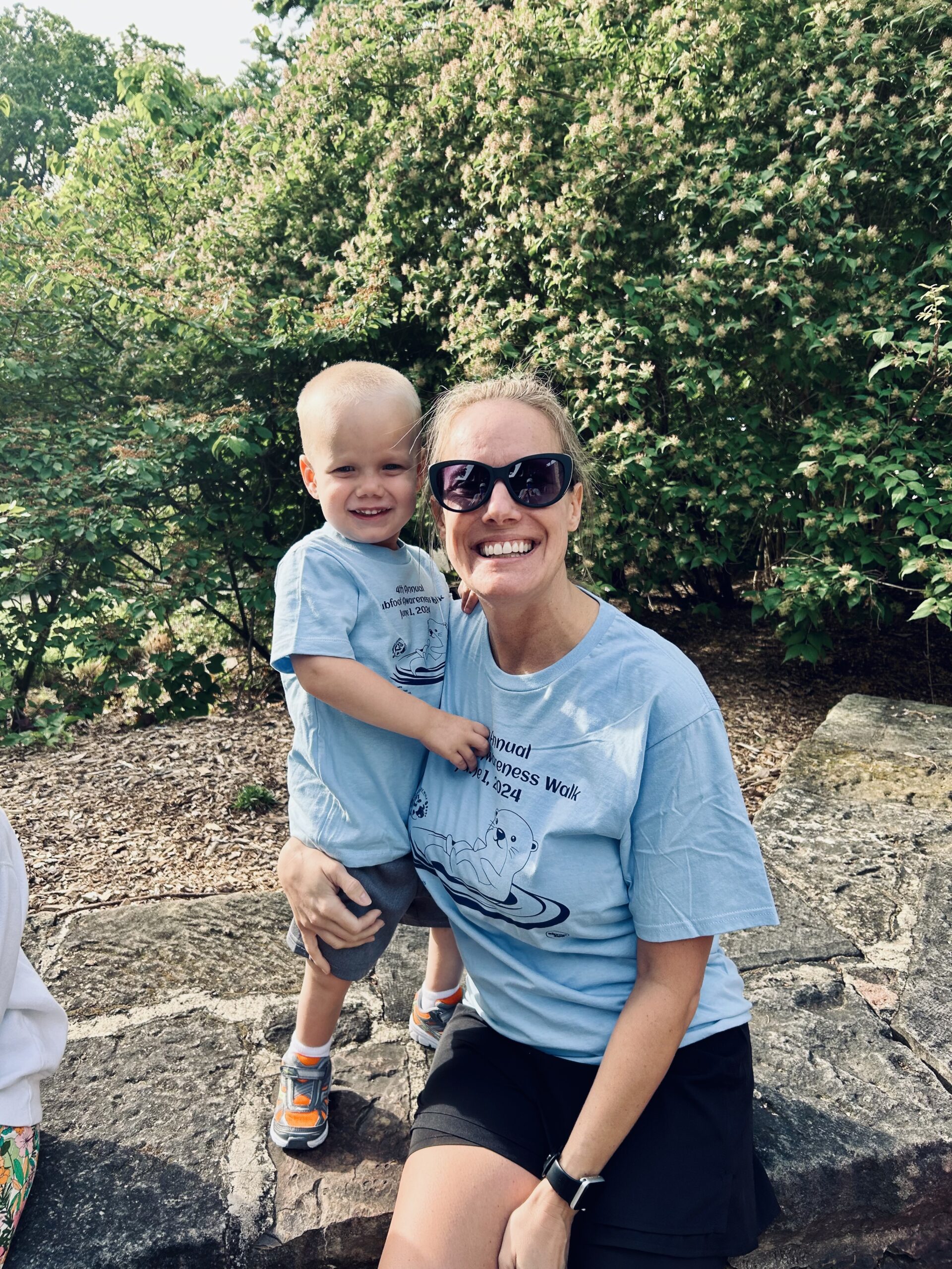 From struggles to smiles, family finds care for clubfoot at Akron ...
