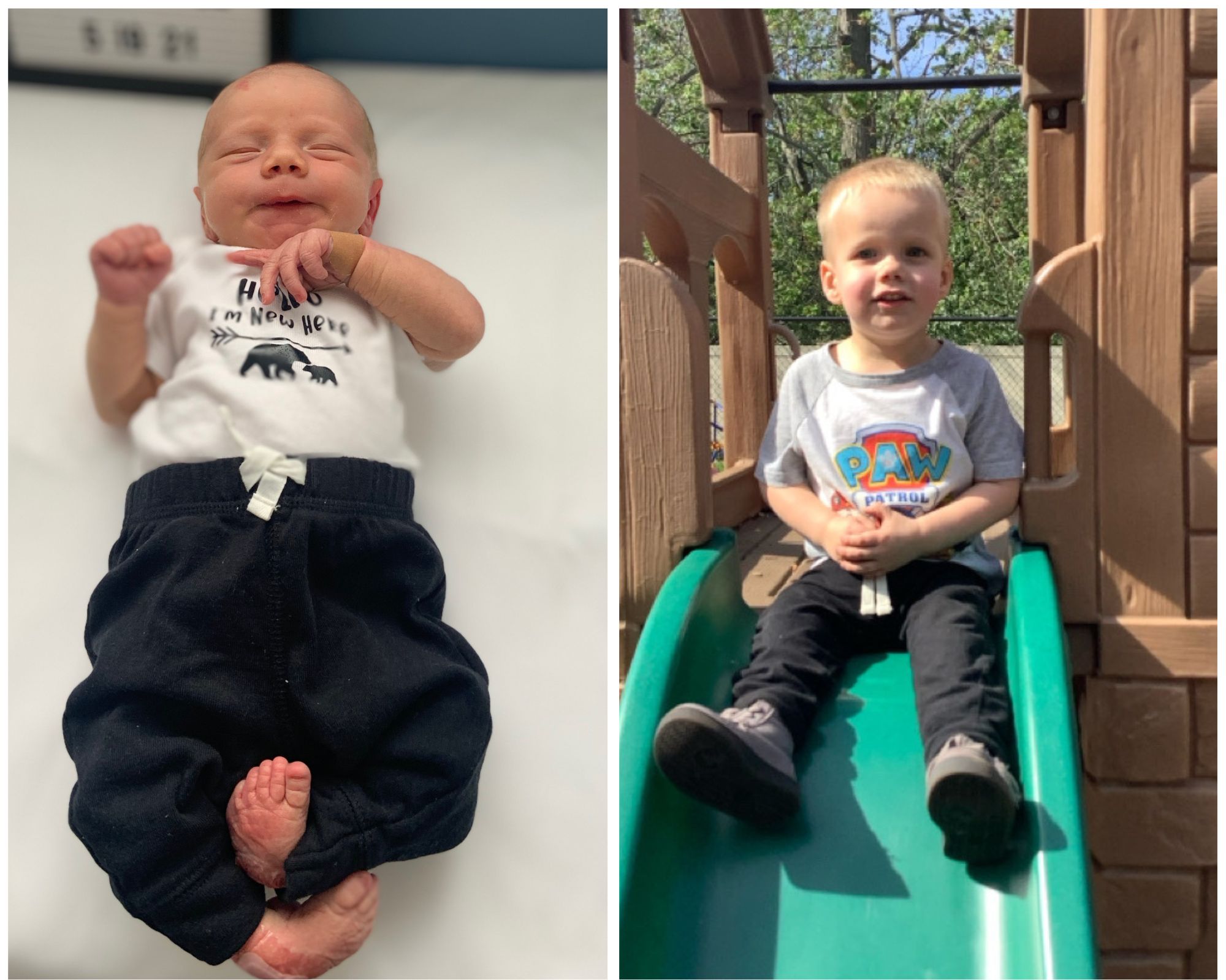 From struggles to smiles, family finds care for clubfoot at Akron ...