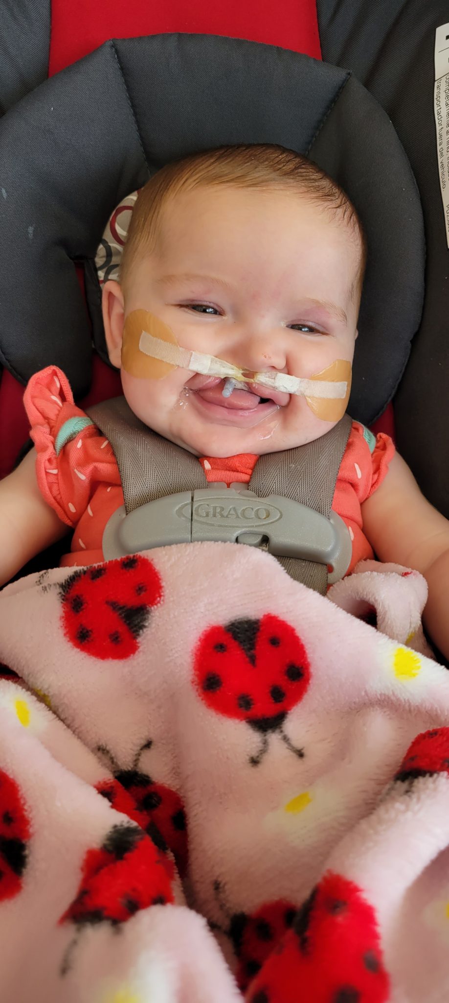 Finding hope and healing after a cleft lip and palate diagnosis ...