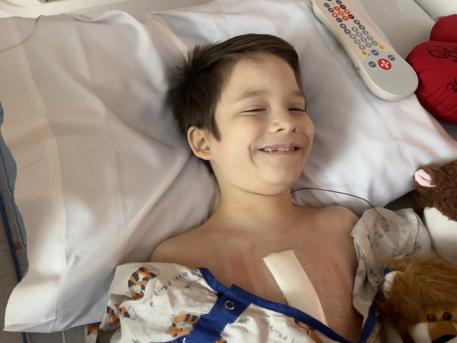 Maze rebounds after open-heart surgery : Inside Children's Blog