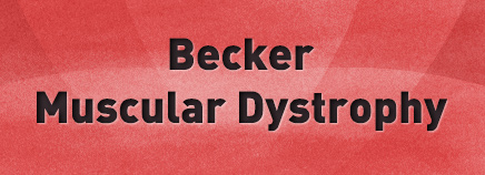 Kidshealth: Becker Muscular Dystrophy | Akron Children's Hospital