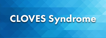 Kidshealth: CLOVES Syndrome | Akron Children's Hospital