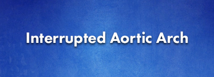 Kidshealth: Interrupted Aortic Arch (IAA) | Akron Children's Hospital