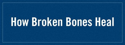 Kidshealth: How Broken Bones Heal | Akron Children's Hospital