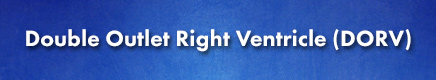 Kidshealth: Double Outlet Right Ventricle (DORV) | Akron Children's ...