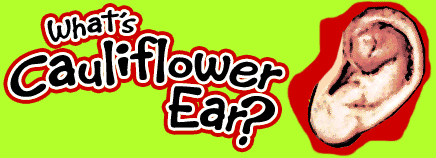 Kidshealth: What's Cauliflower Ear? | Akron Children's Hospital