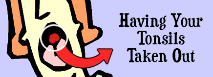 Kidshealth: Having Your Tonsils Taken Out | Akron Children's Hospital