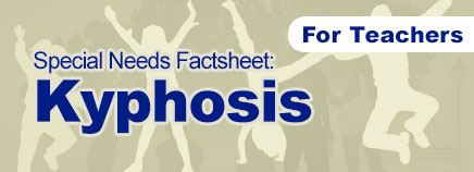 Kidshealth: Kyphosis Factsheet (for Schools) | Akron Children's Hospital