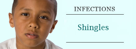 Kidshealth: Shingles | Akron Children's Hospital