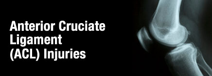 Kidshealth: Anterior Cruciate Ligament (ACL) Tears | Akron Children's ...