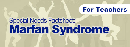 Kidshealth: Marfan Syndrome Factsheet (for Schools) | Akron Children's ...