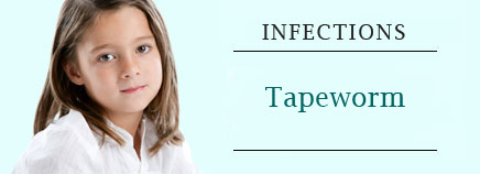 Kidshealth: Tapeworm | Akron Children's Hospital