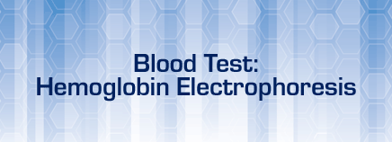 Kidshealth: Blood Test: Hemoglobin Electrophoresis | Akron Children's ...