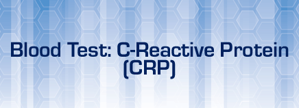 Kidshealth: Blood Test: C-Reactive Protein (CRP) | Akron Children's ...