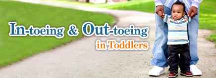 Kidshealth: In-toeing & Out-toeing in Toddlers | Akron Children's Hospital