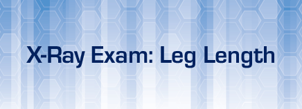 Kidshealth: X-Ray Exam: Leg Length | Akron Children's Hospital