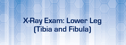 Kidshealth: X-Ray Exam: Lower Leg (Tibia and Fibula) | Akron Children's ...