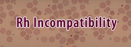 Kidshealth: Rh Incompatibility During Pregnancy | Akron Children's Hospital