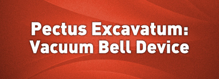 Kidshealth: Pectus Excavatum: Vacuum Bell Device | Akron Children's ...