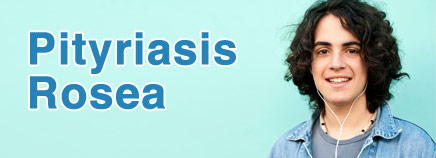 Kidshealth: Pityriasis Rosea | Akron Children's Hospital