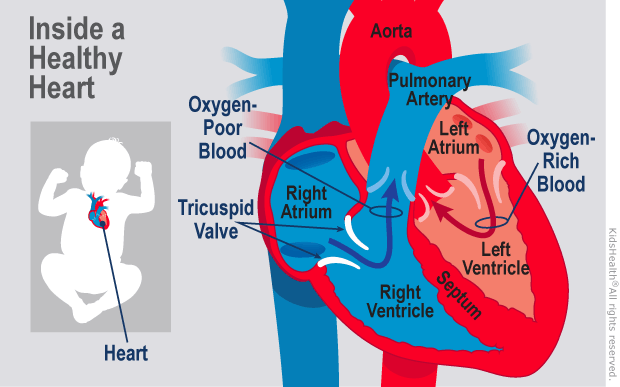 Kidshealth: Tricuspid Atresia | Akron Children's Hospital
