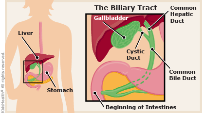 Kidshealth: A to Z: Cholangitis | Akron Children's Hospital